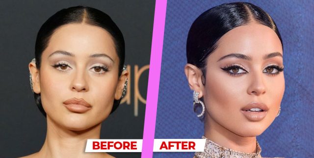 Alexa Demie Before Surgery: Which Type of Surgeries Alexa Demie Have?