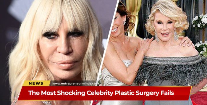 The Most Shocking Celebrity Plastic Surgery Fails
